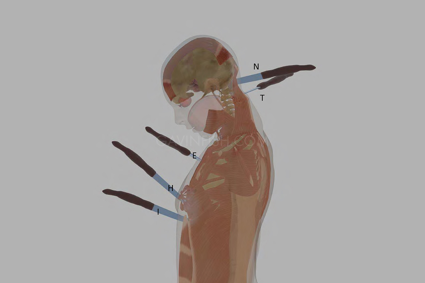 Ellen Greenberg Autopsy