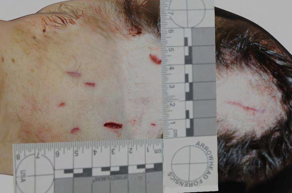 Ellen Greenberg Autopsy